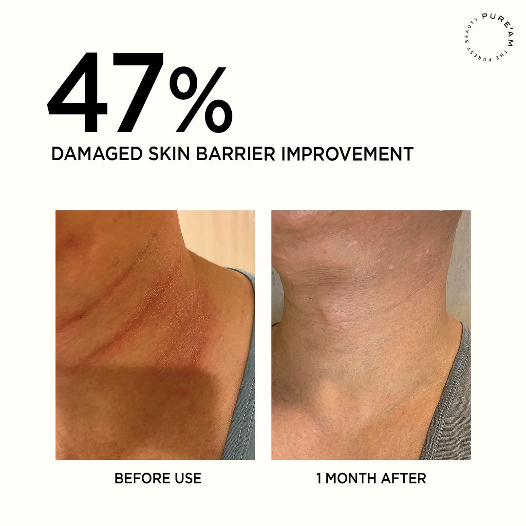 AUTHENTIC BARRIER CREAM BALM | PURE'AM